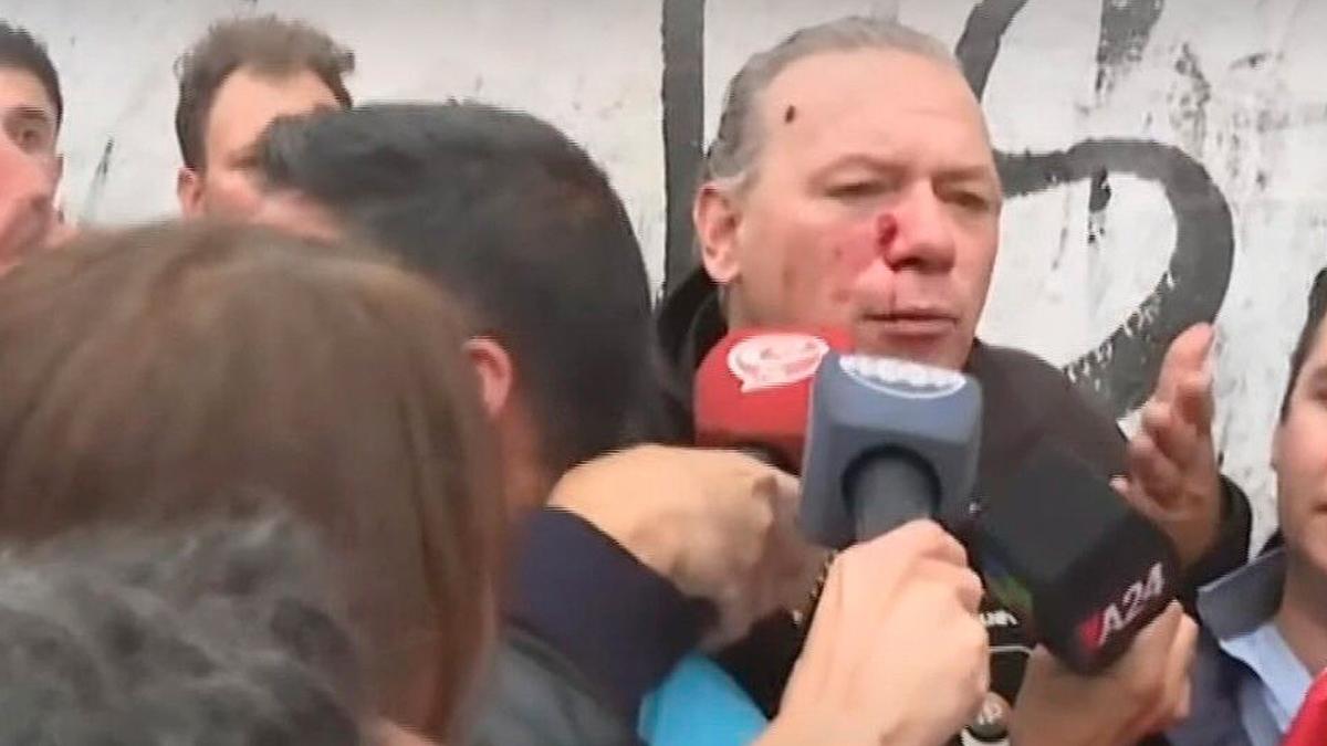 Berni descarta renunciar a su cargo y aseguró que no denunciará a sus ...